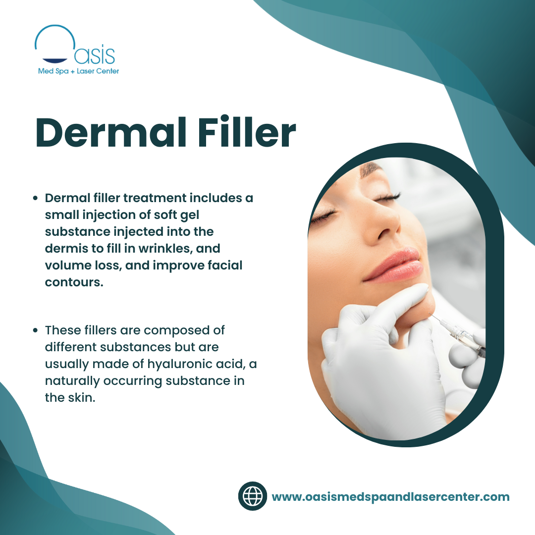 Dermal Fillers: 10 Things You Should Know | Oasis Med Spa and Laser Center