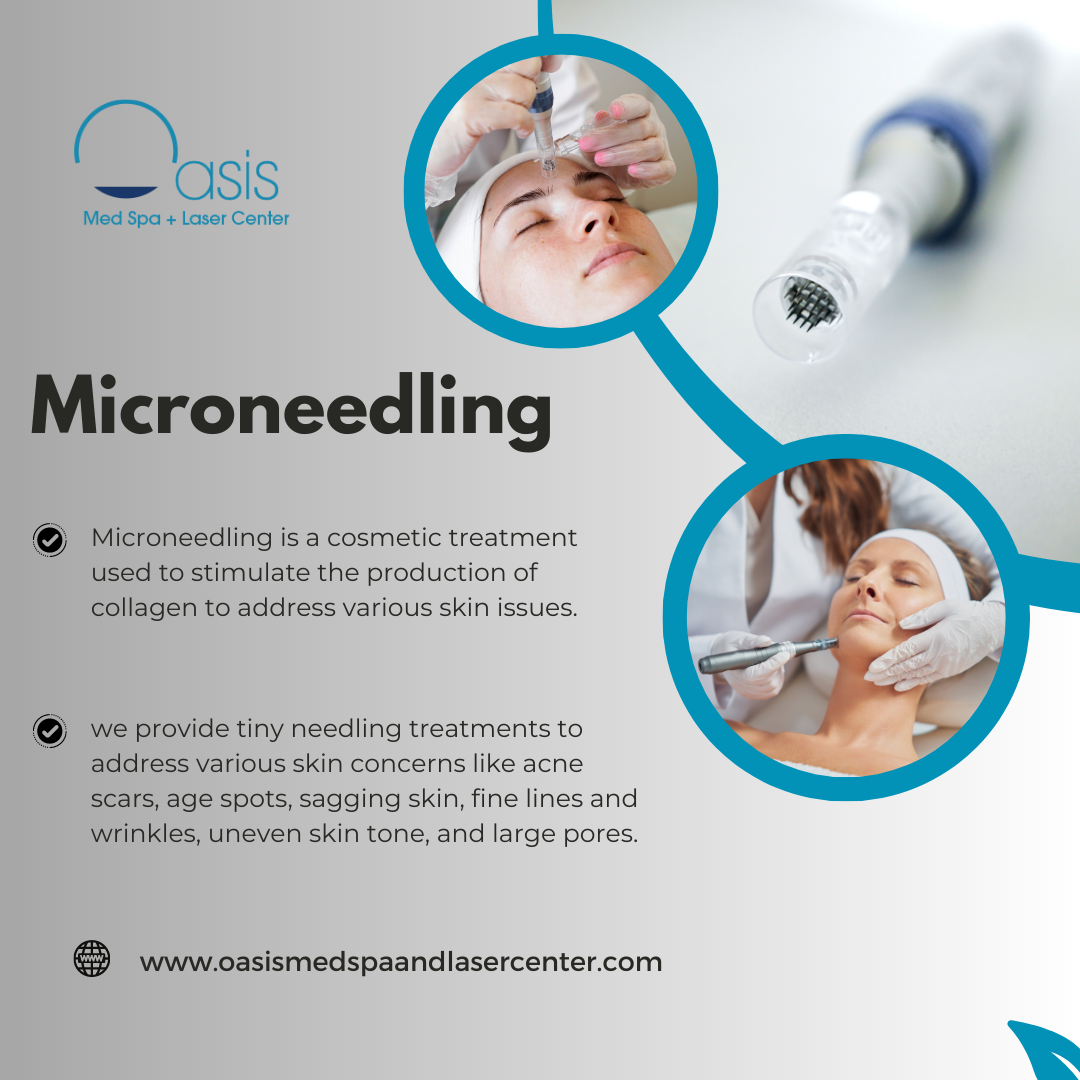 Microneedling: Costs, Benefits, and What to Expect | Oasis Med Spa and ...