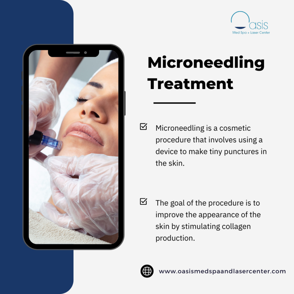 Important Things You Should Know About Microneedling - | Oasis Med Spa ...