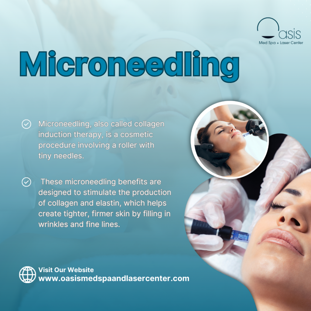 20 Benefits of Microneedling: Top Medspa | Oasis Med Spa and Laser Center